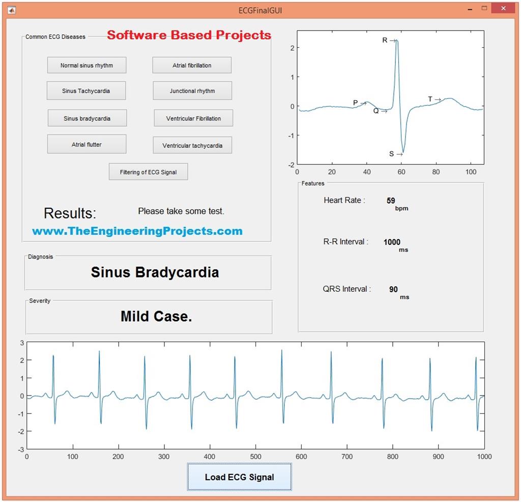 How to Design an Engineering Product - The Engineering Projects