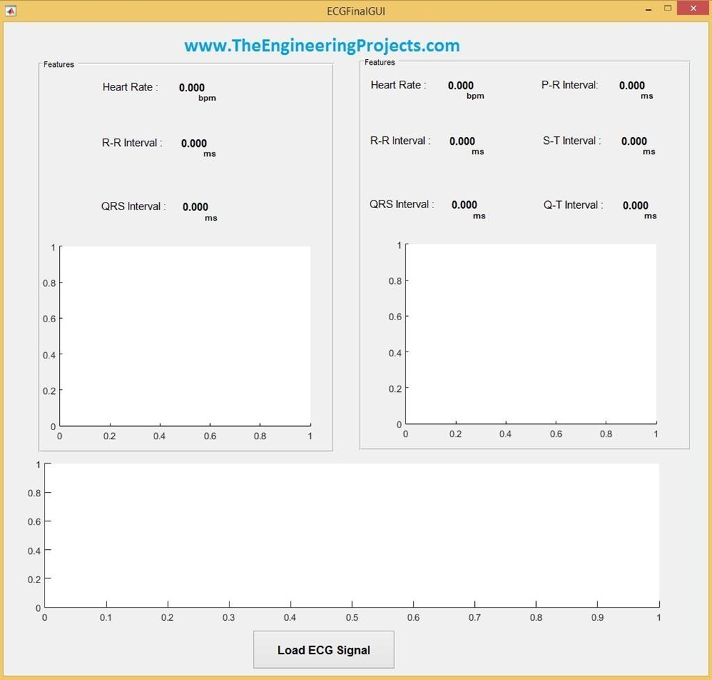 ECG Averaging in MATLAB - The Engineering Projects
