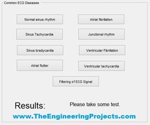 ECG Simulation using MATLAB - The Engineering Projects