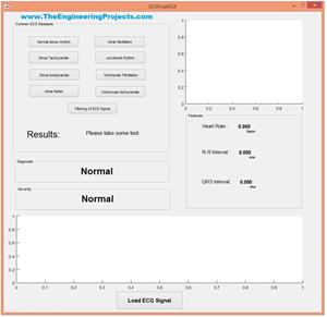 ECG Simulation using MATLAB - The Engineering Projects