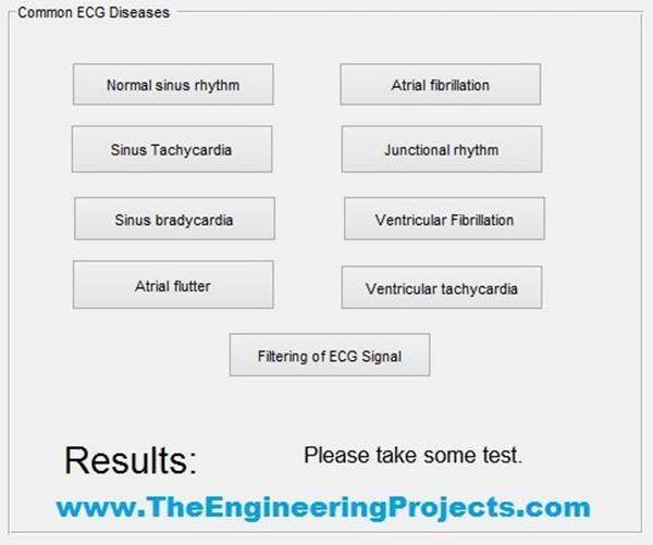 ECG Simulation using MATLAB - The Engineering Projects