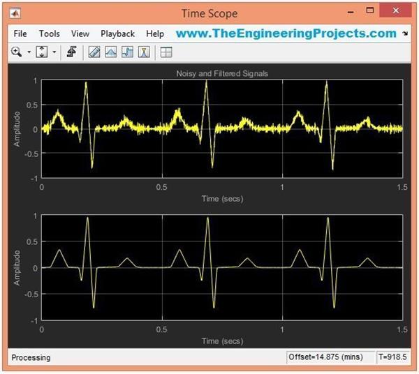 ECG Simulation using MATLAB - The Engineering Projects