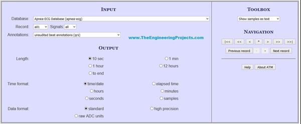 Ecg Simulation Using Matlab The Engineering Projects