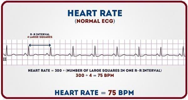 Electrocardiogram(ECG): Definition, Test, Signal Read & Diagnose - The ...