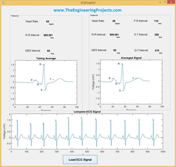 ECG Averaging in MATLAB - The Engineering Projects