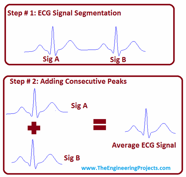 ECG Averaging in MATLAB - The Engineering Projects