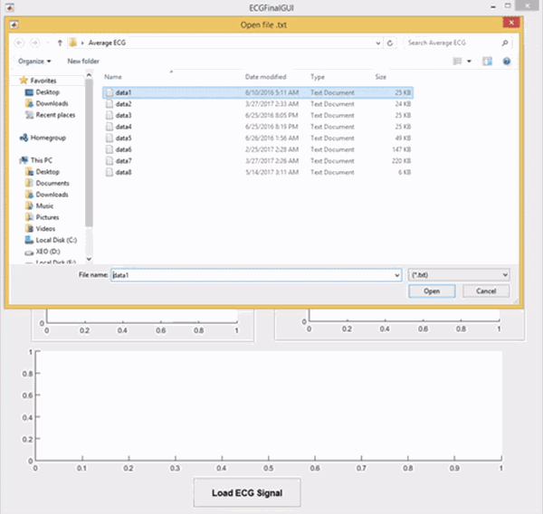ECG Averaging in MATLAB - The Engineering Projects