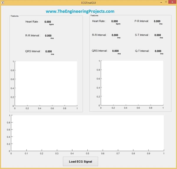 ECG Averaging in MATLAB - The Engineering Projects