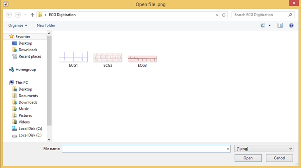 ECG Digitization in MATLAB - The Engineering Projects