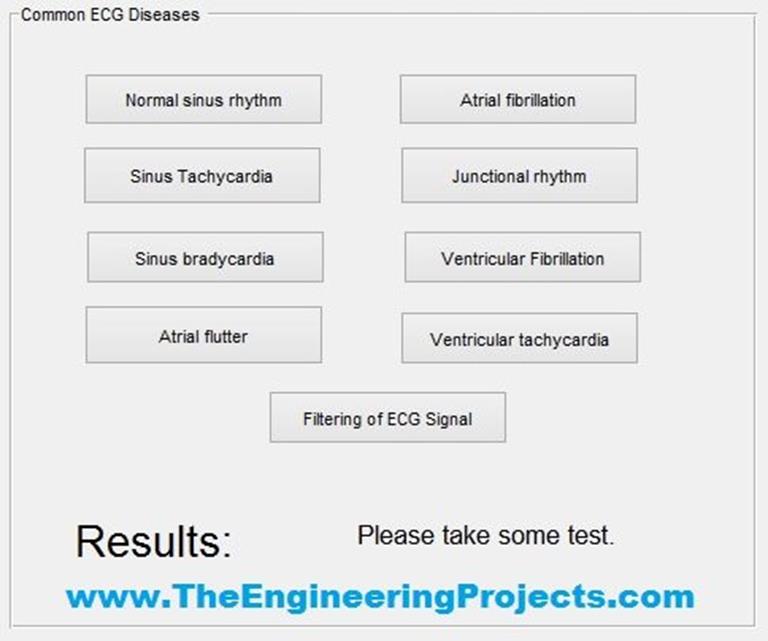 ECG Simulation using MATLAB - The Engineering Projects