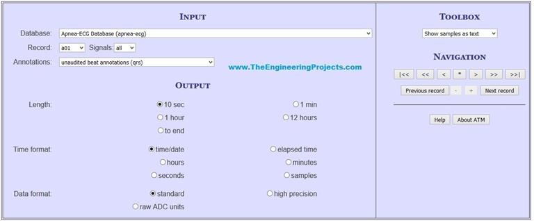 ECG Simulation using MATLAB - The Engineering Projects