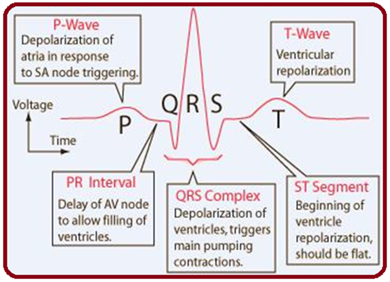 Electrocardiogram(ECG): Definition, Test, Signal Read & Diagnose - The ...