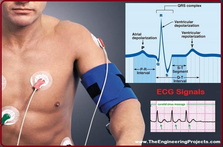 Electrocardiogram(ECG): Definition, Test, Signal Read & Diagnose - The ...