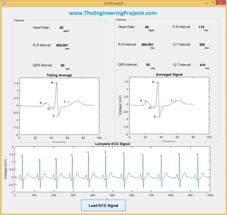 ECG Averaging in MATLAB - The Engineering Projects