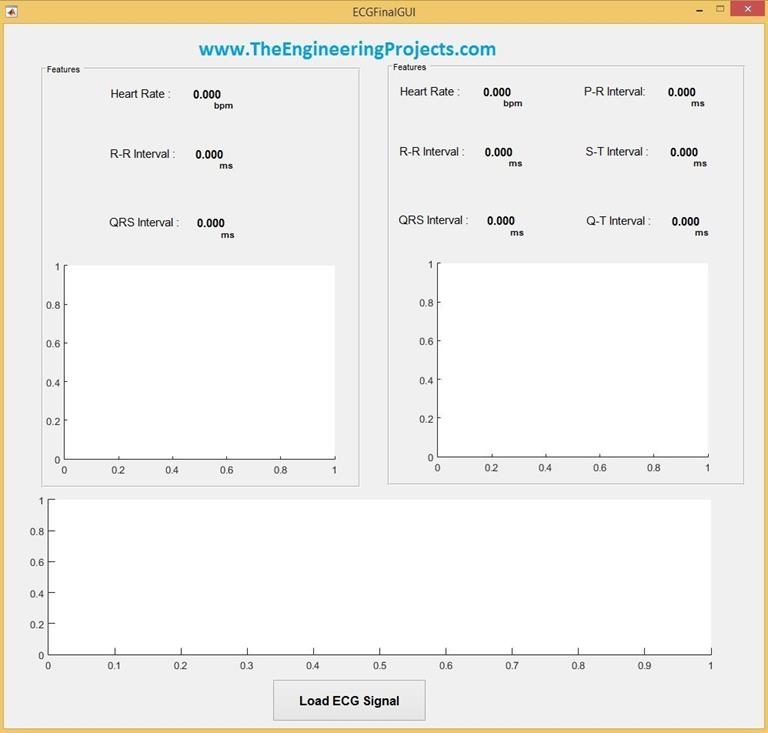 ECG Averaging in MATLAB - The Engineering Projects