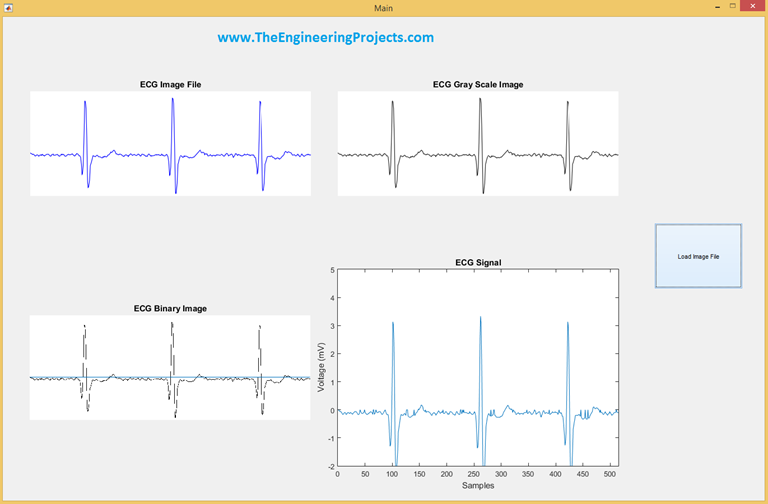 ECG Digitization in MATLAB - The Engineering Projects