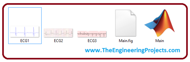 ECG Digitization in MATLAB - The Engineering Projects